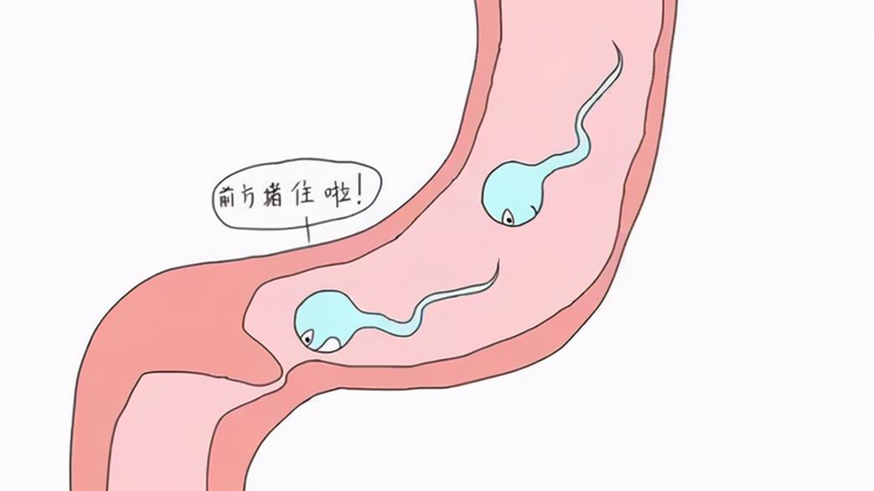 想备孕输卵管堵塞怎么办?医生:这2种办法可以帮你成功怀孕