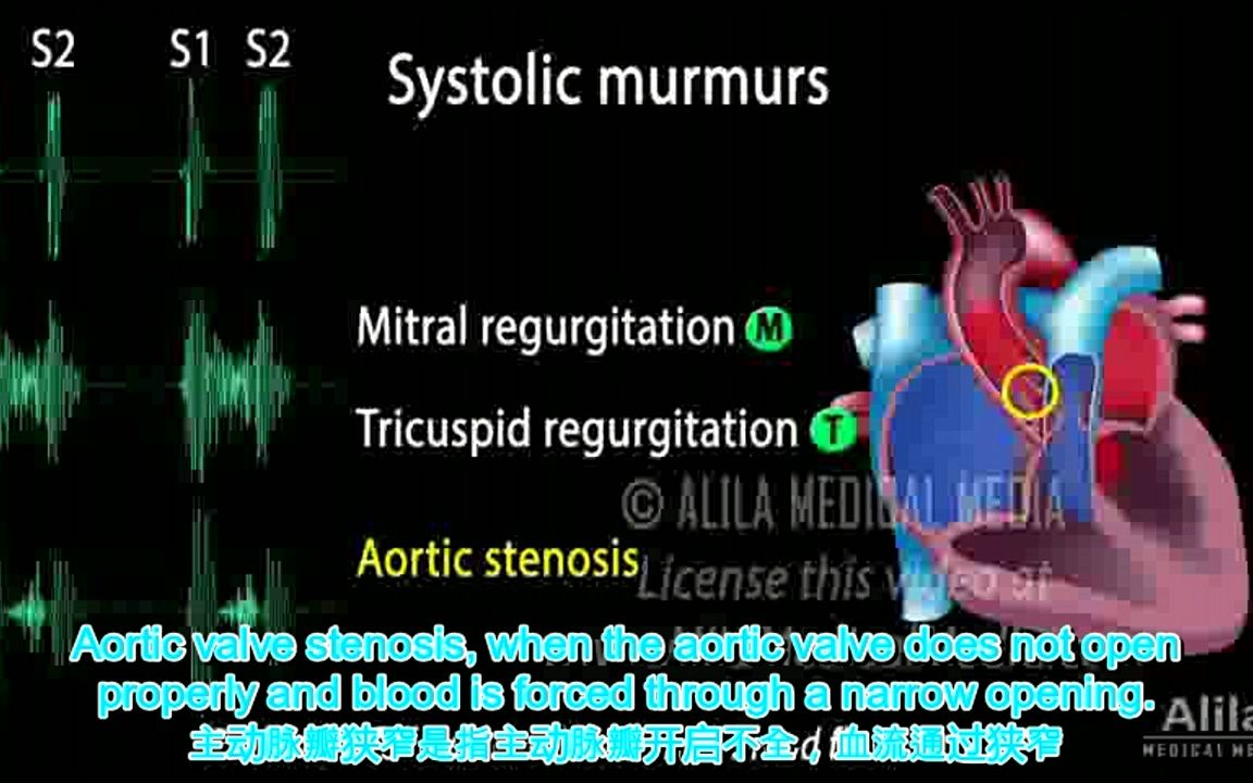 心音和心脏杂音科普