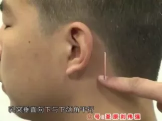 治疗颈源性头痛天牖穴