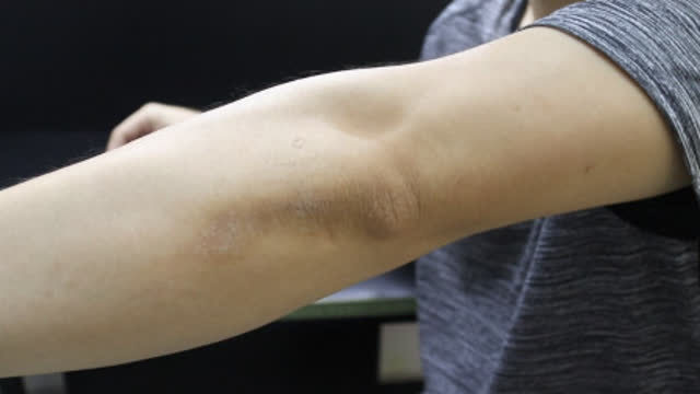 去死皮不求人,现在清楚还不算晚,涨知识了