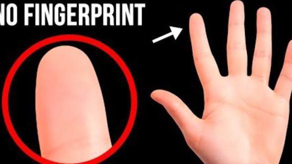 如果手上没有了指纹,会出现什么后果,看完这个动画你就明白了