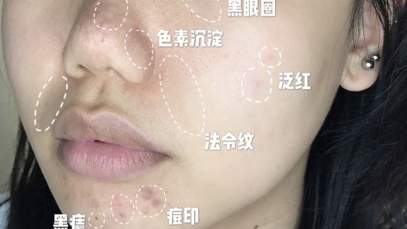 自拍不用磨皮?妹子ps级别的遮瑕方法,瑕疵皮问题肌一次性解决!