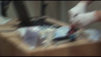 中医针灸手法之王合民刺络放血疗法