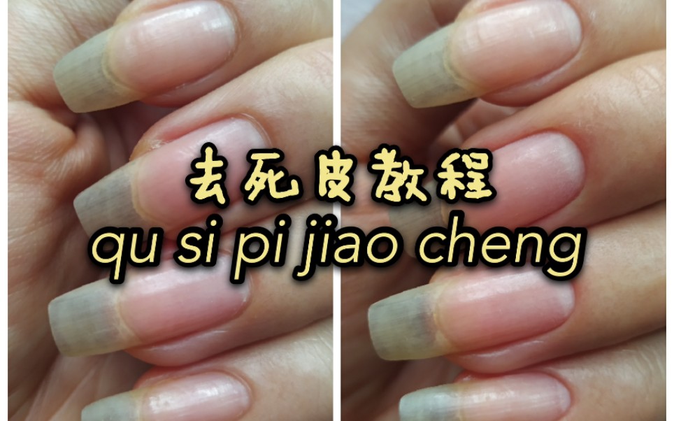 超级详细手把手去死皮教程