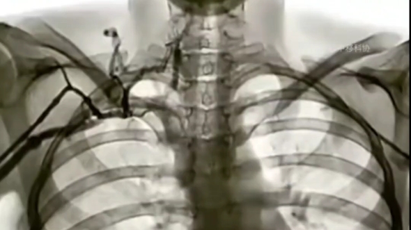 血液在身体里是怎么流动的