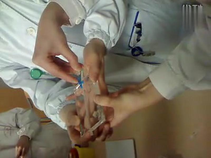 贝朗留置针进针