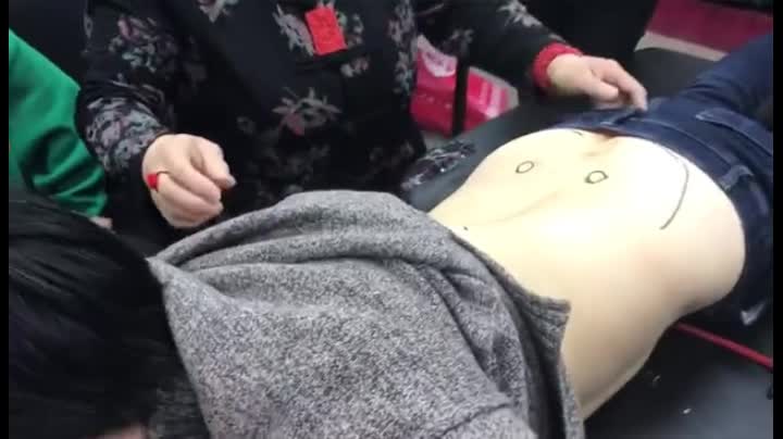 针灸的操作方法视频-夏连红夏氏脐针治疗乳腺增生