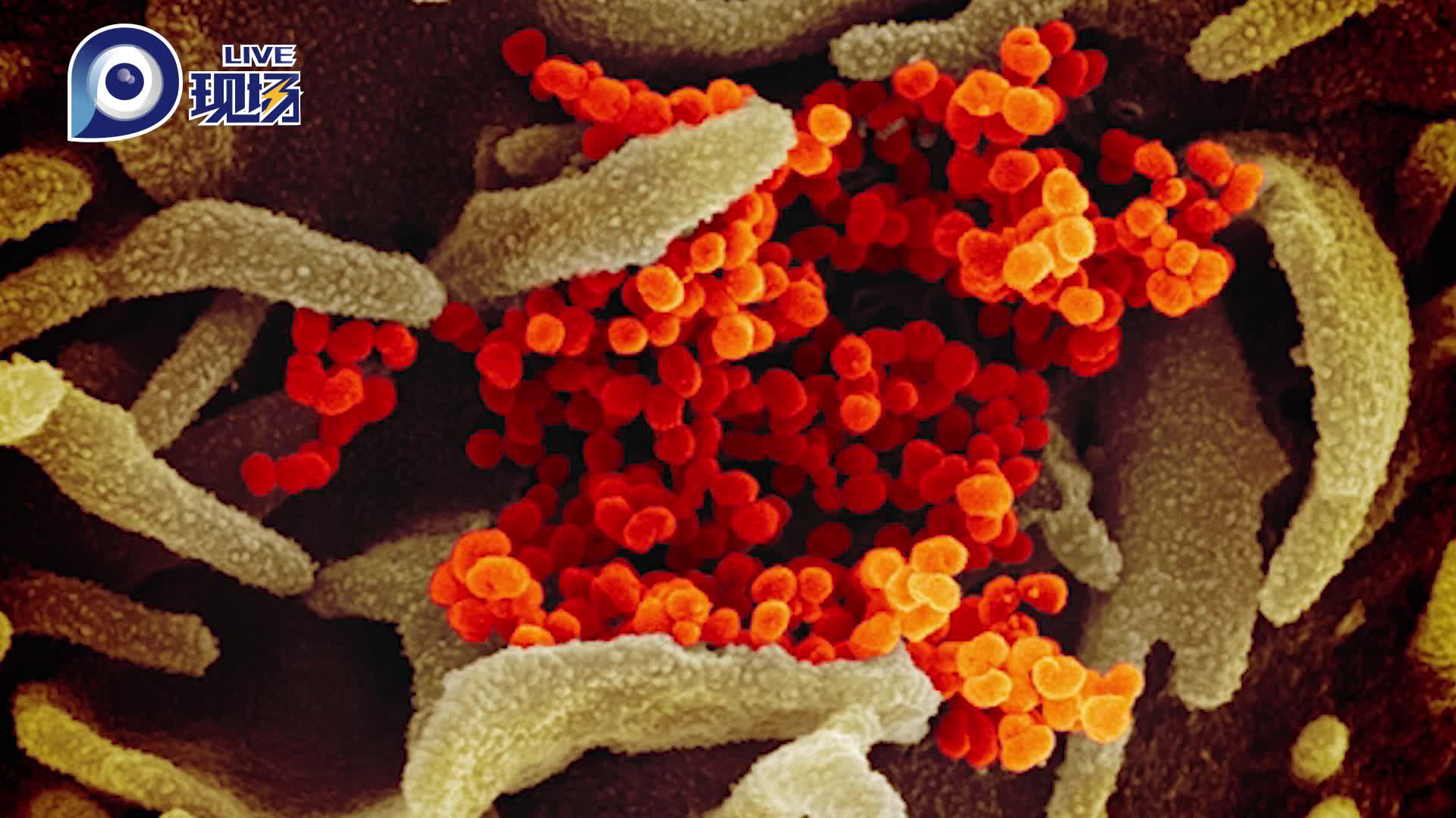 新冠病毒长这样!显微镜彩照首度公布,与SARS病毒十分相似