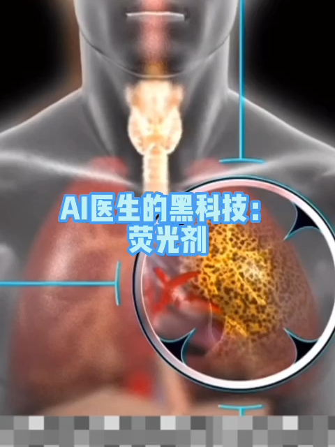 探秘医学前沿发展:AI医生的黑科技---荧光剂