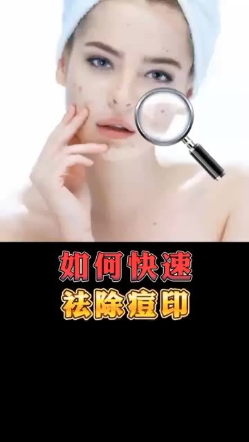 这个关键成分就是壬二酸和水杨酸