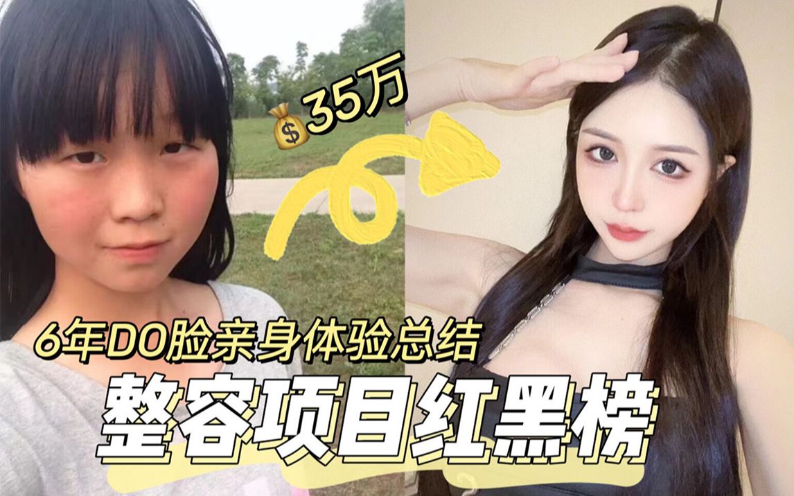 整容医美项目红黑榜 6年35万亲身经验总结 植发/双眼皮/隆鼻/线雕/隆胸