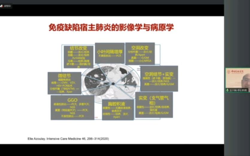...肺炎的治疗现状 王一民教授(强烈推荐呼吸科、感染科、急诊、全科...