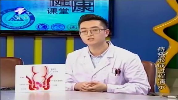 痔疮是怎么形成的,有什么临床症状?专家现场演示过程,来看看