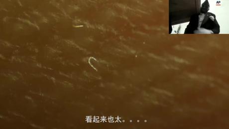 显微镜下的手指,看看你的手指究竟有多脏