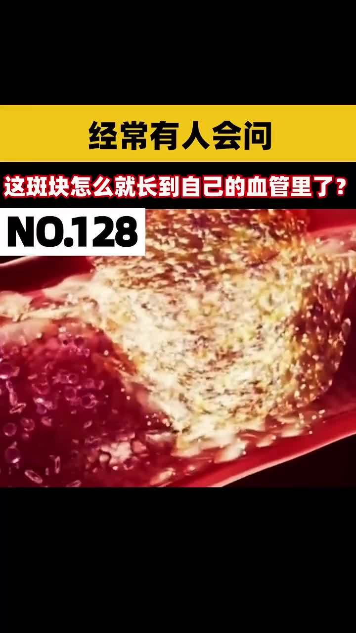 ...斑块为什么会长在了自己的血管里呢?斑块 动脉粥样硬化 动脉斑块 ...