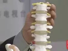 专家讲解离子通络拨针疗法