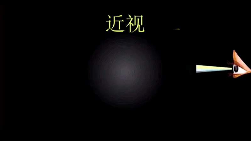 为什么会近视,你的眼睛发生了什么