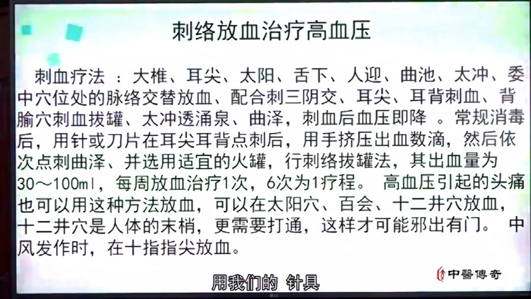 刺络放血疗法治疗高血压-王合民(中医针灸培训班视频教学)