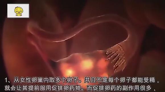 揭秘试管婴儿全过程,看着都痛,真的心疼女人!每个母亲都很伟大