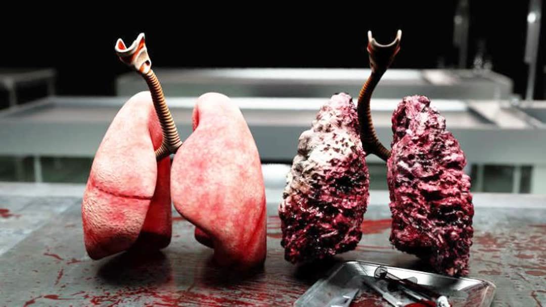 肺癌检查的“金指标”?医生直言：这5个影像学检查，别忽视