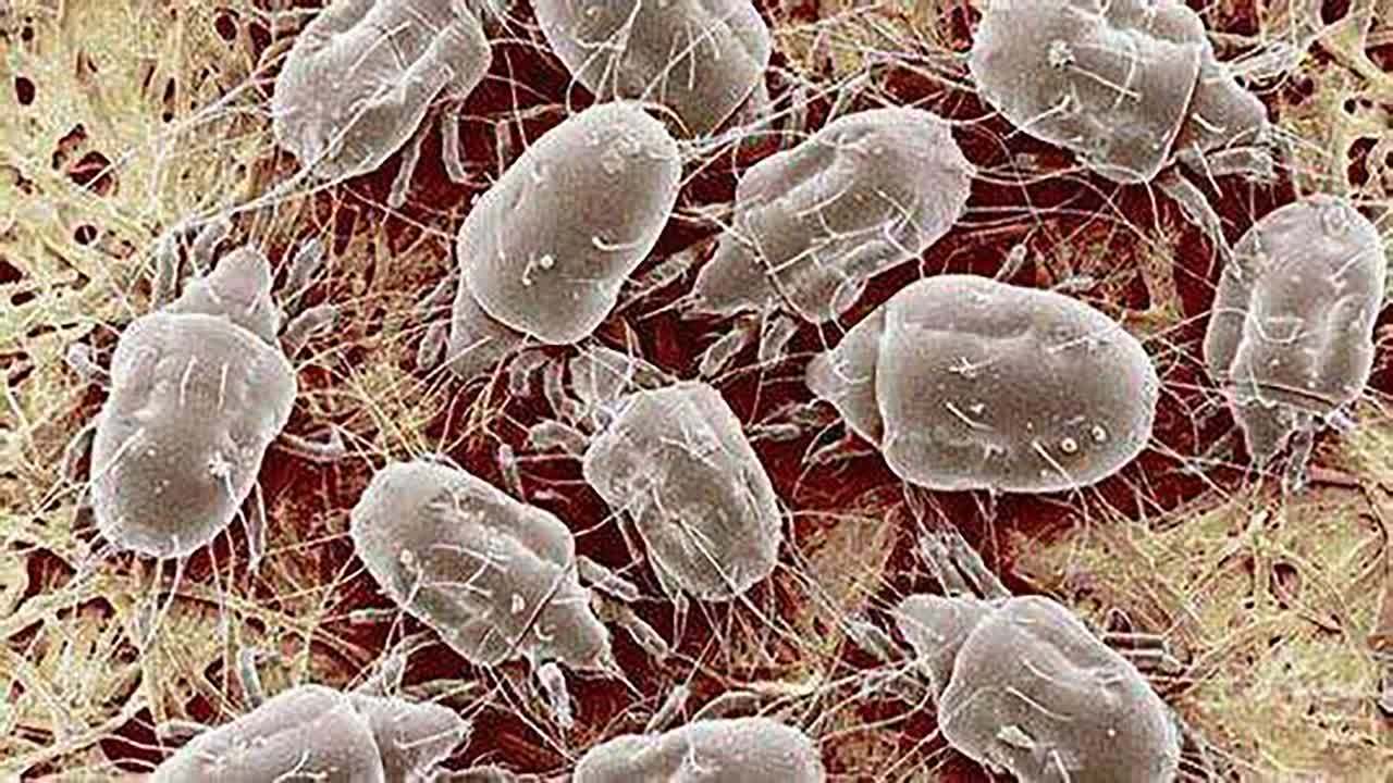 今天才知道,原来螨虫最怕它,只需一分钟,就可以将螨虫全杀死