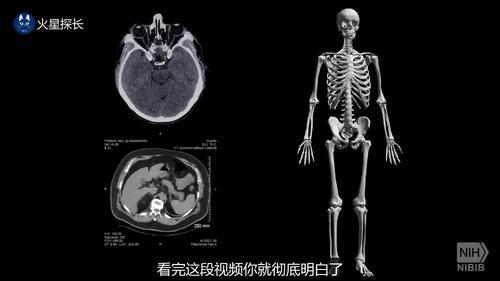 CT机是如何瞬间“看透”你的,拍CT为啥费用很高?两分钟看明白