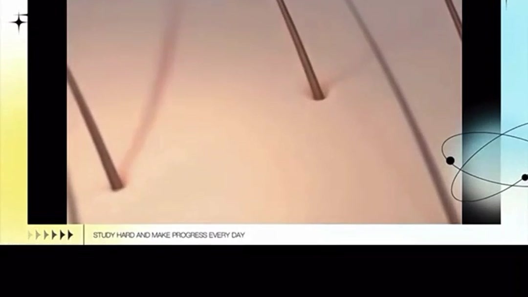 动画演示痘痘形成的全程!#知识科普#长痘