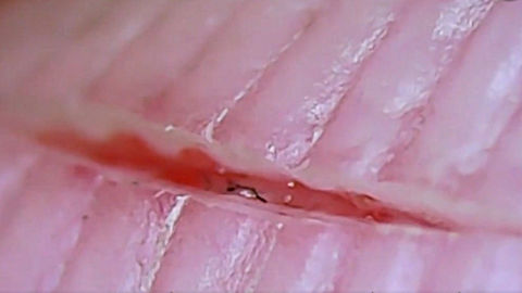 人体受伤后的伤口是如何修复的?动画模拟全过程,场面太壮观了