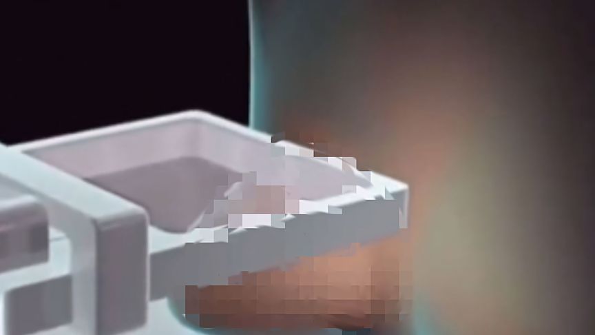 乳腺癌已成为全球第一大癌症,动画演示乳腺钼靶检查全程