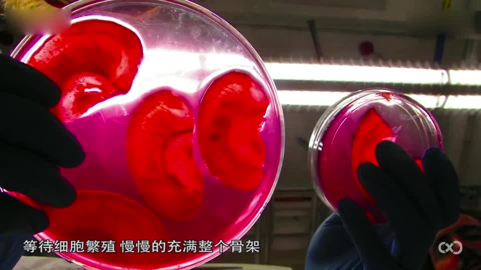 菠菜叶做心脏组织, 苹果造耳朵, 医学发展进入新领域