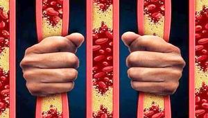 这8个坏习惯,正一天天堵塞你的血管,悄悄夺走你的寿命!