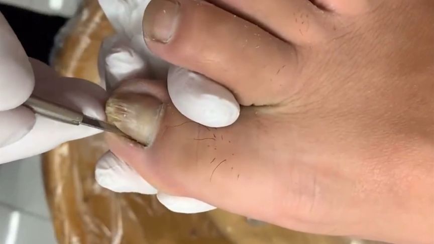 超解压,修脚指甲～这是一期有味道的视频!