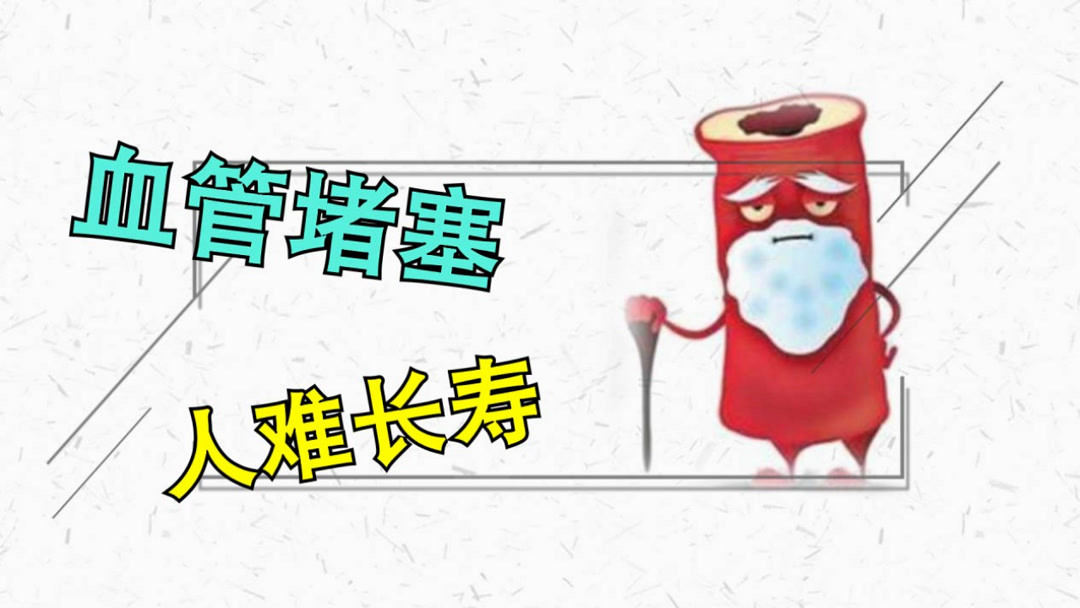 血管堵塞,人难长寿!身体有2种症状,小心脑梗