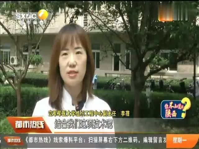 医生攻克医学难题 "牙髓再生术"让坏牙死而复生