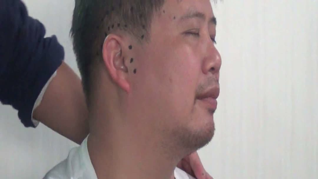 中医推拿培训:李均峰瑶医扶阳推拿手法,头疼的头部治疗操作