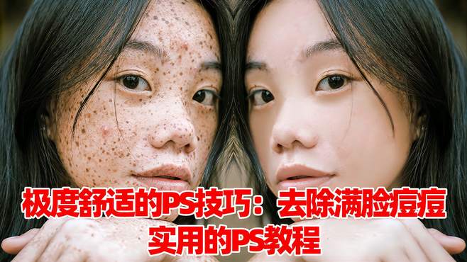 极度舒适的PS技巧:去除满脸痘痘,实用的PS教程!