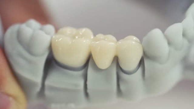 牙齿如何种植?3D技术全景还原!看完表示很疼!