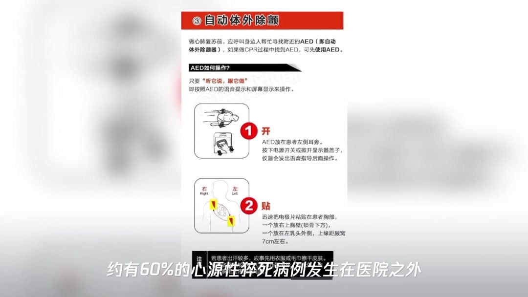 我国每年心源性猝死者高达55万人!看了这个能救命