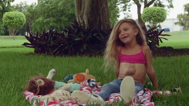 长在身体外面的心脏,血液流动都看得见,怎么会这样?