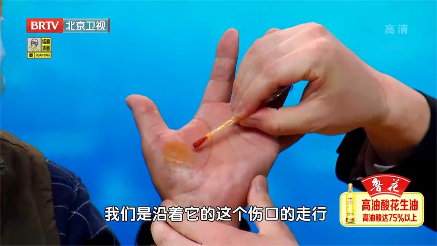 擦伤、烫伤后,如何正确清洁伤口?