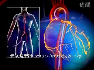 心脏病:什么是冠状动脉造影