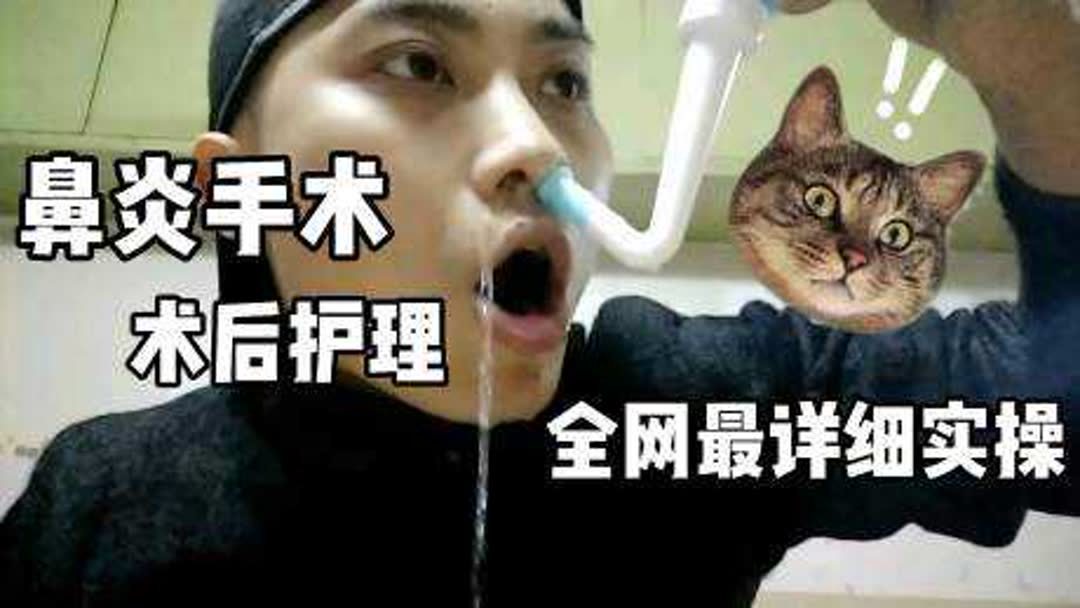 你有鼻炎吗?你被鼻炎所困扰吗?全网最详细鼻炎手术术后护理