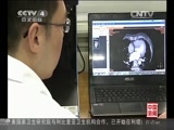 [中国新闻]上海:利用3D打印技术 成功实施心脏手术