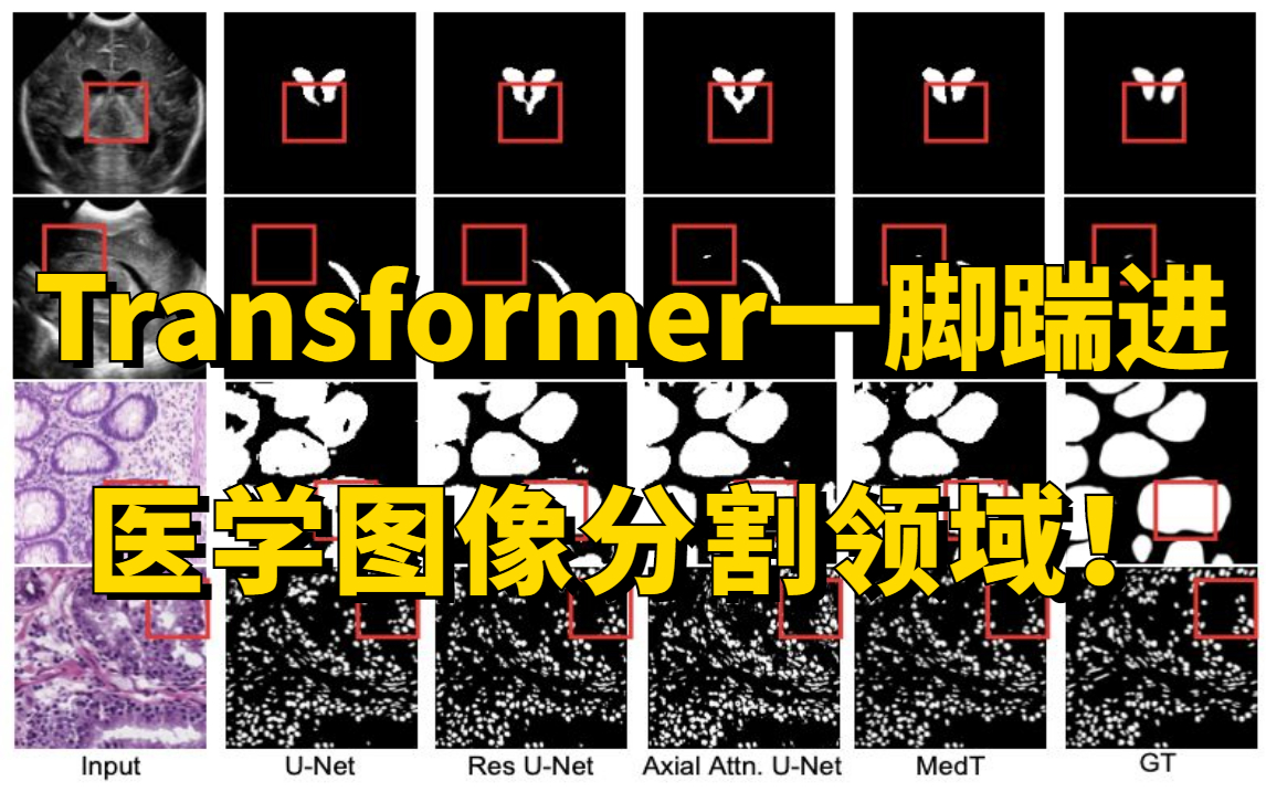 ...基于Medical Transformer的医学图像分割实战教程,论文解读+源码...
