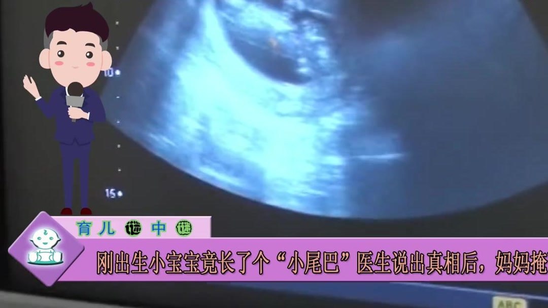 刚出生宝宝长了"小尾巴",麻麻痛哭