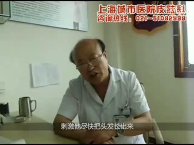 脱发的原因在线咨询-上海城市医院皮肤科