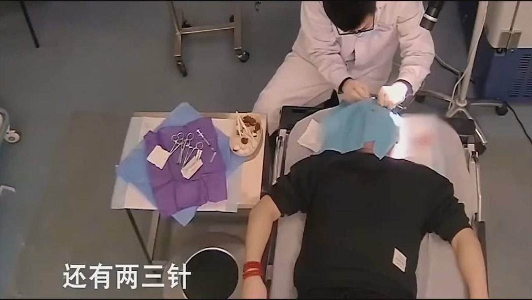 头部外伤必须缝针止血,医生没打麻药直接上,病人没说一个疼字
