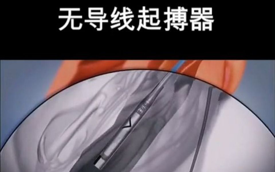 无导线起搏器,治疗心动过缓,带动心脏跳动