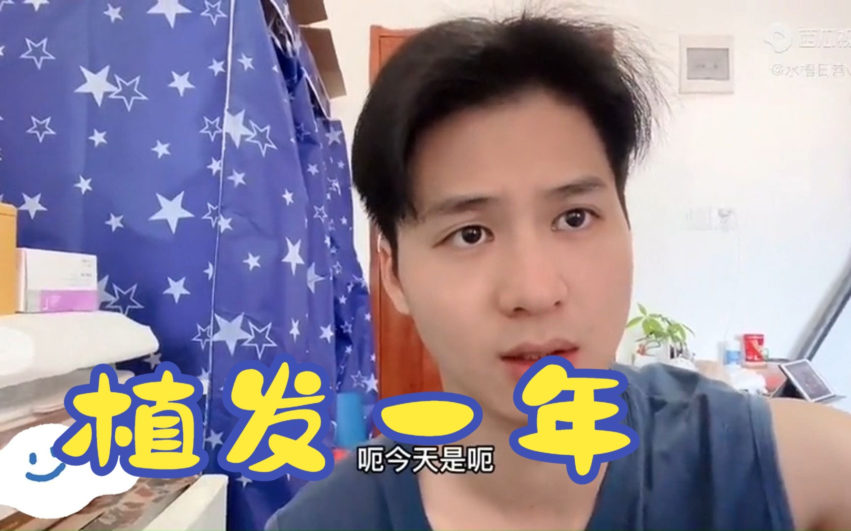 植发一年,3000单位,里程碑式的术后效果堪比整容,值得记录