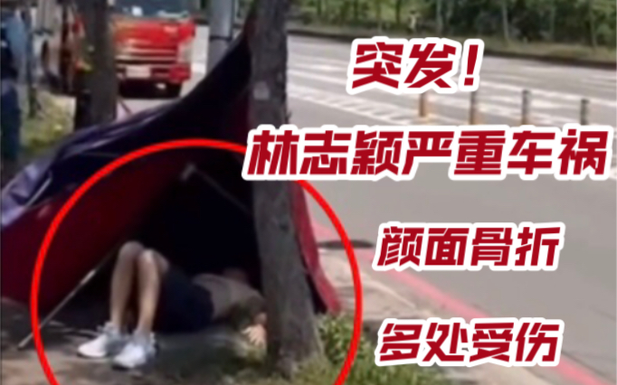 医生曝林志颖伤情:颜面骨折,脑受伤,要再手术!万幸没有生命危险!